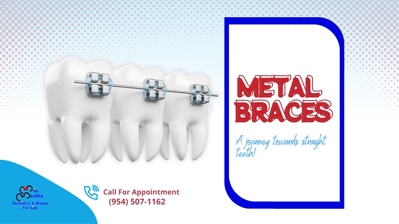 Metal Braces in Coral Springs, FL